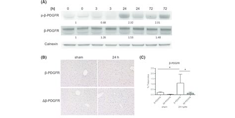 Activation Of B Pdgfr Occurs After Partial Hepatectomy A Mice Download Scientific Diagram
