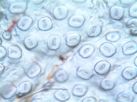 Multiple Species Leaf Stomata Instance Segmentation Dataset By Jiaxin