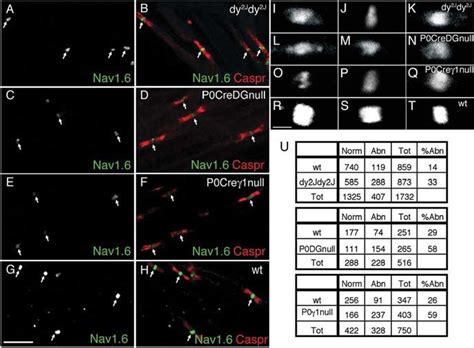 Abnormality In Nav Clusters In The Absence Of Laminins Or Dystroglycan Download Scientific
