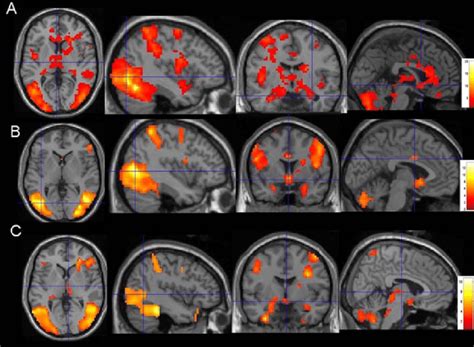 Statistical Parametric Maps Of Activation For All Subjects Viewing Download Scientific Diagram
