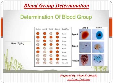 Blood Group Determination Ppt