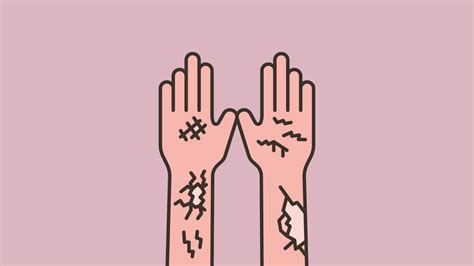 Sarcoidosis Skin Lesions Pictures Causes Treatment