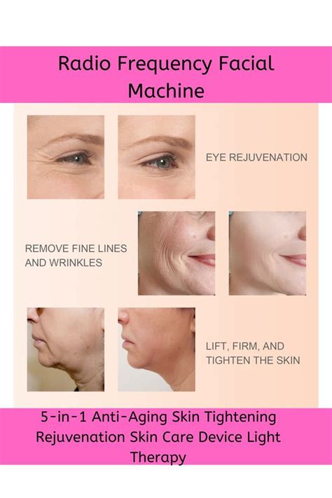 Rf Skin Tightening And Why You Need It Artofit