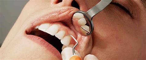 Understanding Cosmetic Dentistry Procedures And Benefits