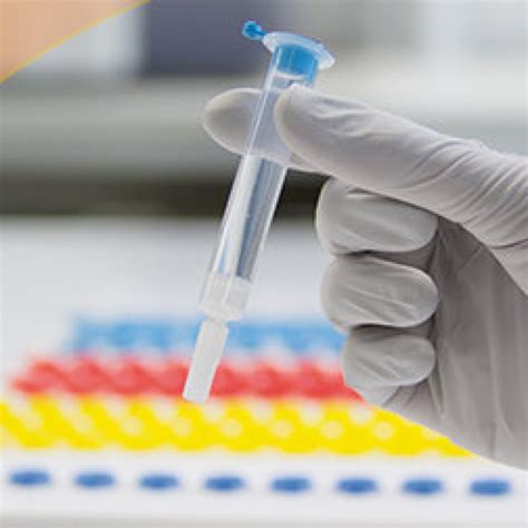 Multi Mycotoxin Analysis Simultaneous Sample Purification For 11 Mycotoxins En Food And Feed