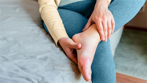 Understanding Psoriatic Arthritis Spotting Symptoms And Choosing The