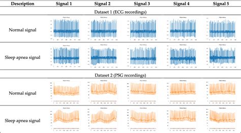 Figure 1 From An Adaptive Sleep Apnea Detection Model Using Multi