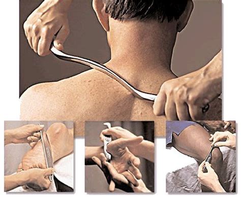 Graston Technique® • Back To Health Chiropractic And Acupuncture