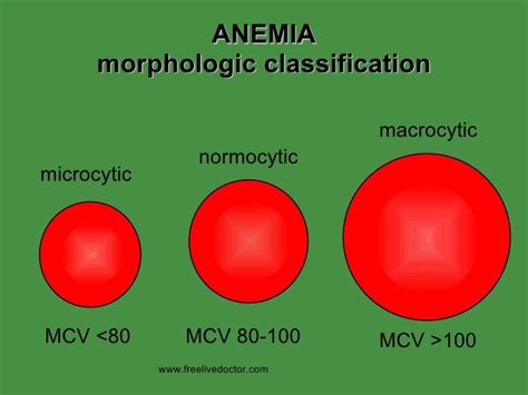 Meaning Of Macrocytic Anemia At Mitchell Gretchen Blog