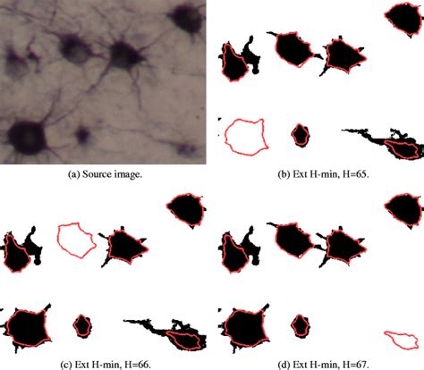 example of cell segmentation with extended h minima for lgn red color