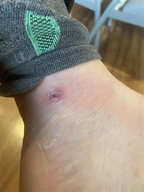 Is This Getting Better R Dermatologyquestions