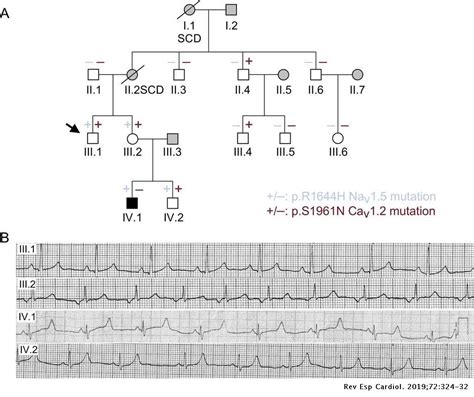 Digenic Heterozigosity In Scn5a And Cacna1c Explains The Variable Expressivity Of The Long Qt