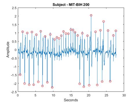 Wavelets In Matlab Acetopic