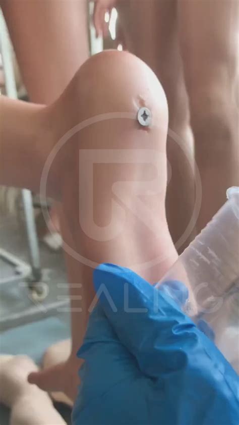 Silicone Glue For Sex Doll Skin Cuts Spartan Lover