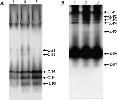 Effect Of Exogenous Application Of 1 Mm Spermidine Spd On Peroxidase Download Scientific