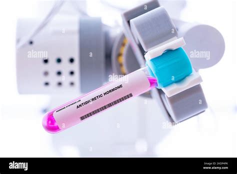 Antidiuretic Hormone Test Tube With Artificial Hormone In Robot Hand