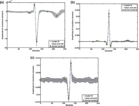 Fully Automatic Modeling Of Ecg Signals As Mixture Of A Finite Number Download Scientific