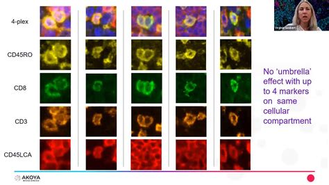 Spatial Phenotyping With Opal From Manual To Automated Multiplex Staining Akoya