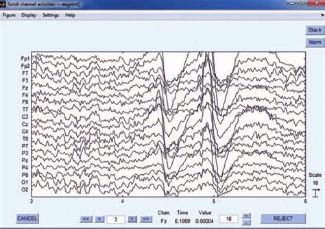 4 Eeg Ocular Artifact Oa Download Scientific Diagram