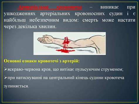 Надання домедичної допомоги при кровотечах Види кровотеч презентация онлайн