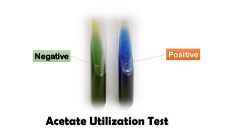 Acetate Utilization Test Introduction Principle Test Requirements