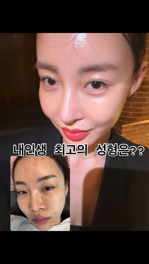 강자매 어젯밤 사이 바쿠치올 구성이 품절되어 31일 배송으로 수량땡겨왔어요🩷🩷 근데 바쿠치올 다들 얼마나 쟁이시는거예요