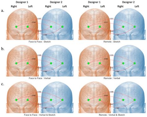 Brain Sciences Special Issue Advances Of Ai In Neuroimaging