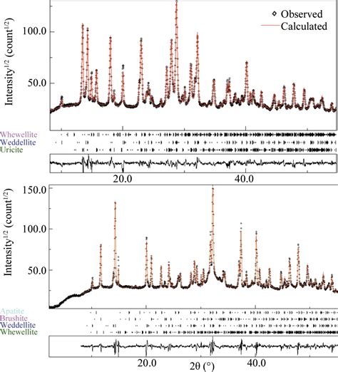 Iucr Qu­antitative Phase Analysis And Microstructural Characterization Of Urinary Tract