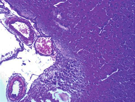 Brain Hemispheres Cortex Of A Rat At Intragastric Introduction Of