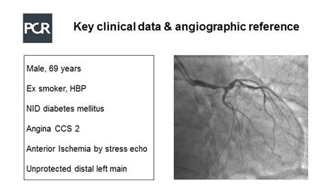 Complex Pci In High Bleeding Risk Patients