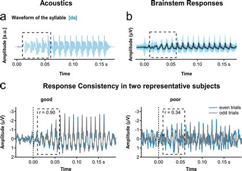 Acoustic Stimulus And Speech Evoked Brainstem Responses A Stimulus
