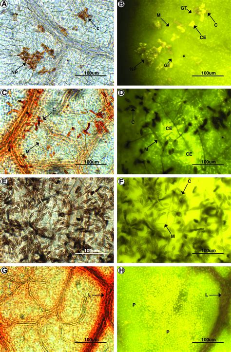 Microscopic Observations Of Leaves From Pear1 9 Pear2 Progeny Download Scientific Diagram