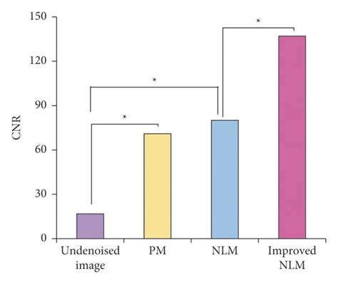 the objective evaluation results of different noise reduction