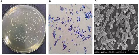 Bifidobacterium Longum Vai Trò Với Hệ Tiêu Hóa Của Trẻ Nhỏ