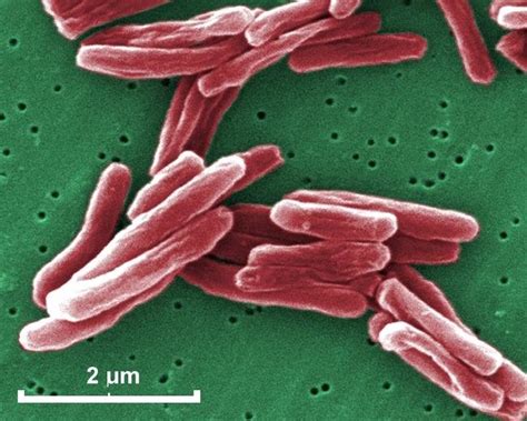 Mycobacterium Tuberculosis Reference Photo Cdcjanice Hanecarr 2015