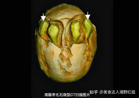 这种深山野果南酸枣，农村人天天见到，却没人知道它到底是什么！ 知乎