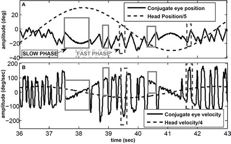 Vor In Response To Sinusoidal Head Rotation Recorded With Eog A