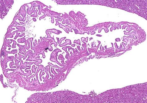 Gallbladder Labeled Histology Dictionary Normal Gallbladder The