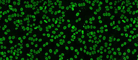 Ana Hep 2 Fluorescent Test System Immuno Concepts