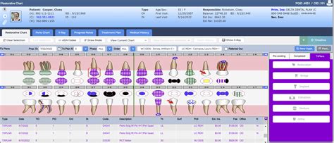Denticon Dental Practice Management Software Planet Dds