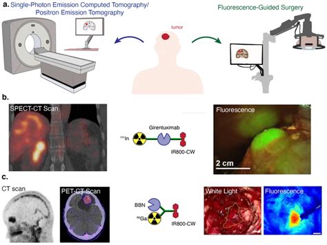 A General Schematic Of Dual Modal Imaging B Spect Ct And
