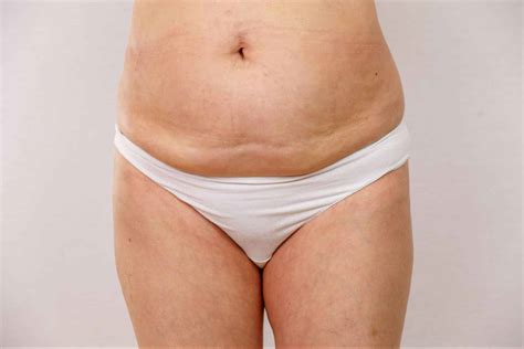 What Happens To Your Vagina As You Age Dr Len Kliman