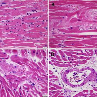 Electrocardiogram Ekg A Admission Ekg Did Not Show Abnormalities Download Scientific