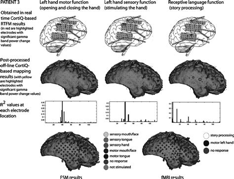 Functional Mapping Results From Three Different Mapping Modalities Download Scientific Diagram