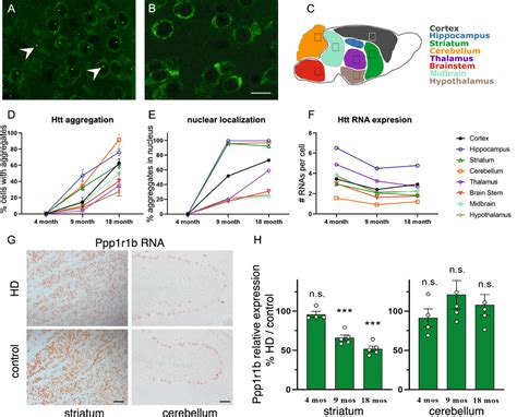 s4 hdhq200 mice show hd typical neuropathology by 9 months of age a