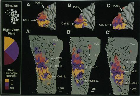 Cortical Representation Of Visual Field Quadrants In Occipital Lobes Of Download Scientific