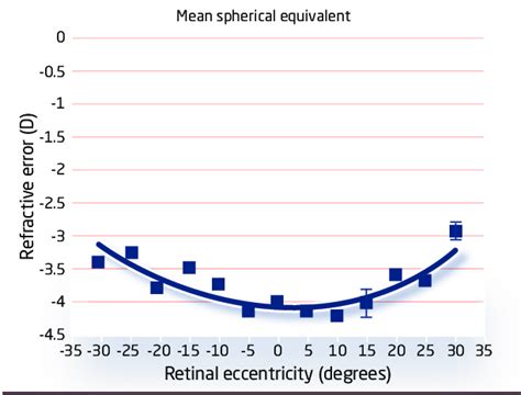 Peripheral Refractive Error Of A 4d Myope Refraction At 30 Degrees In Download Scientific