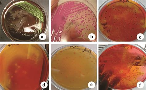 Growth Of Different Bacterial Isolates On Different Selective Growth