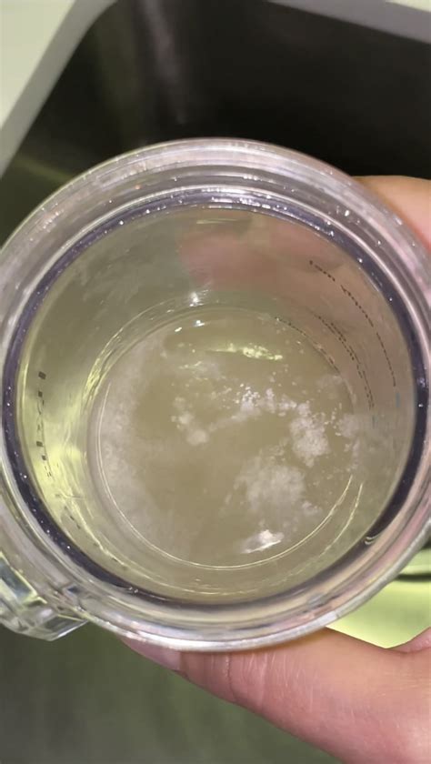 I Tried A Scalp Detox See The Hair Photos Ps Beauty