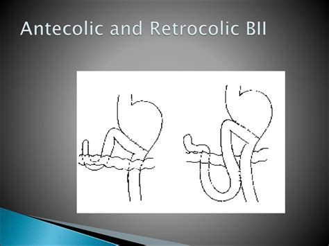 Clinical Anatomy Of Abdominal Cavity Online Presentation